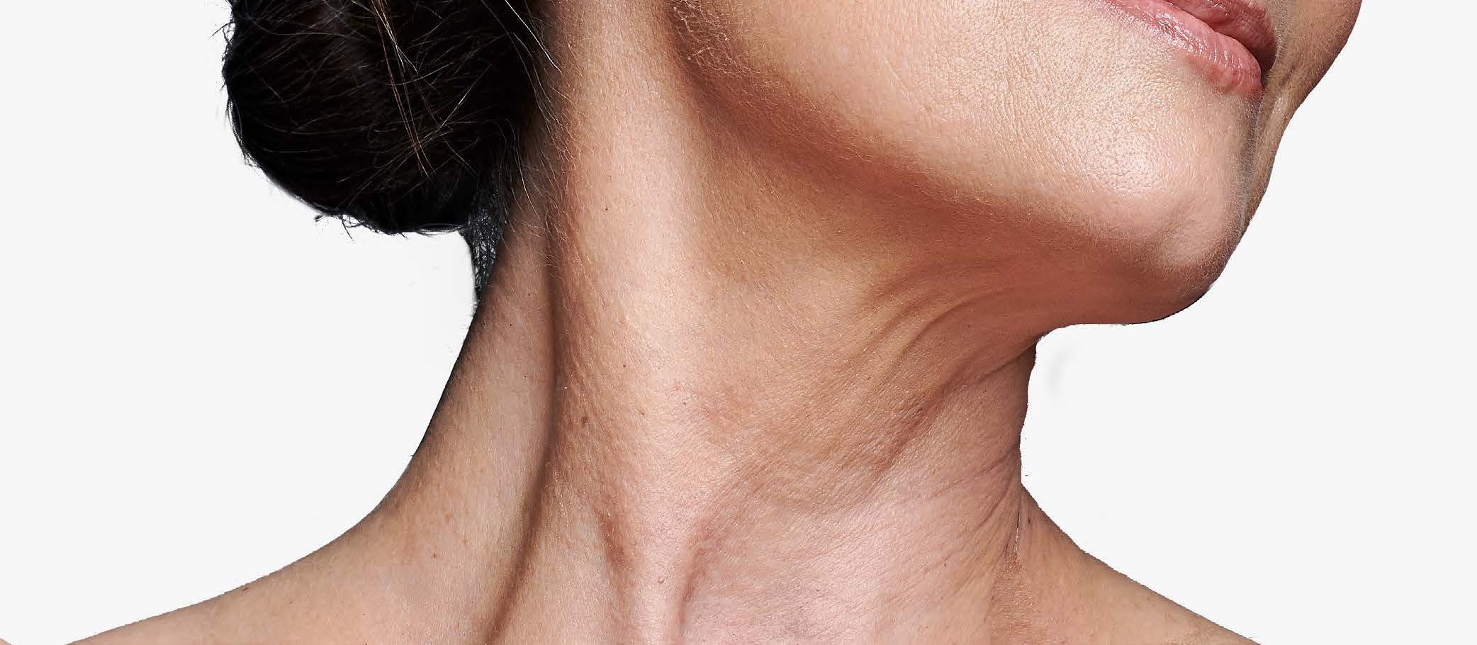 Why Does Neck Skin Sag? - International Dermal Instititute